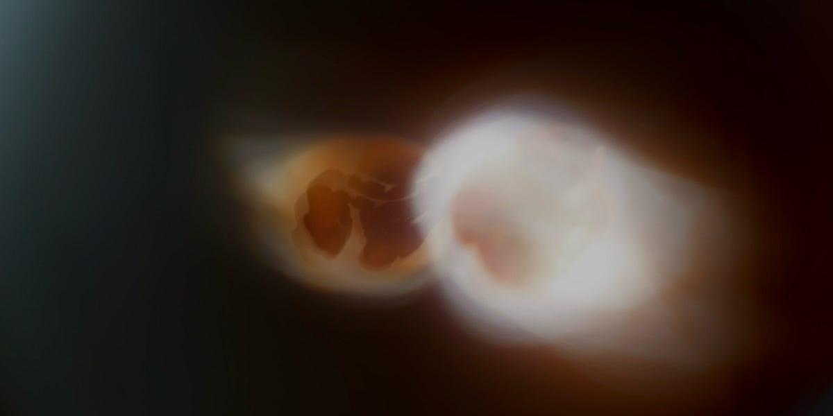 Auspices - by Corey Frey - A Brusk Night’s Crisp Morning