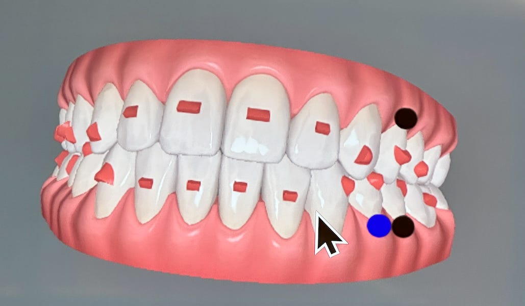Brace Yourself - by Veronica PW - Selfscribe