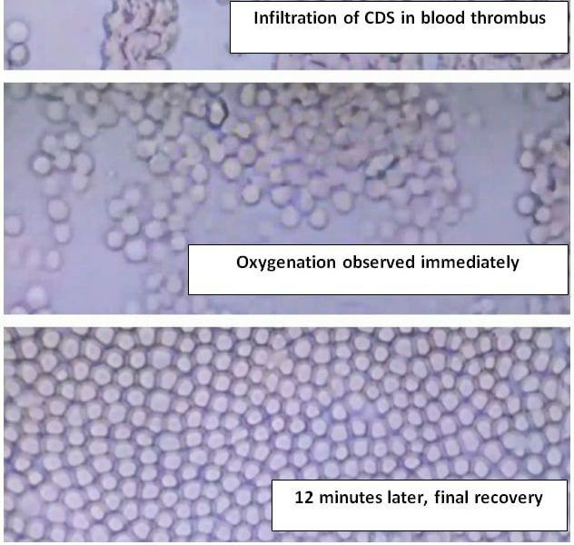 Understanding the Effects of Different Chlorine Dioxide Preparations on ...