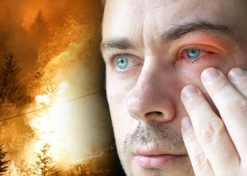 Are Wildfires Fueling an Increase in Pink Eye?