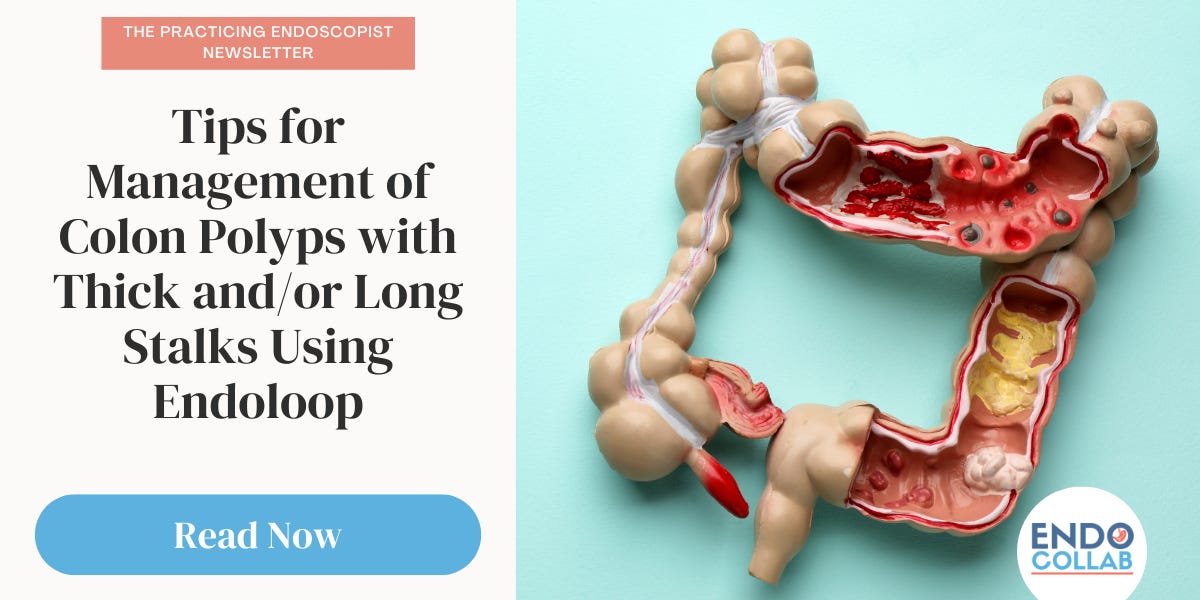 Tips For Management Of Colon Polyps With Thick And Or Long Stalks Using