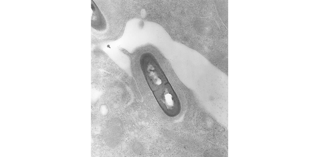 Listeria 101: Characteristics, Controls, Latest Research and Guidance