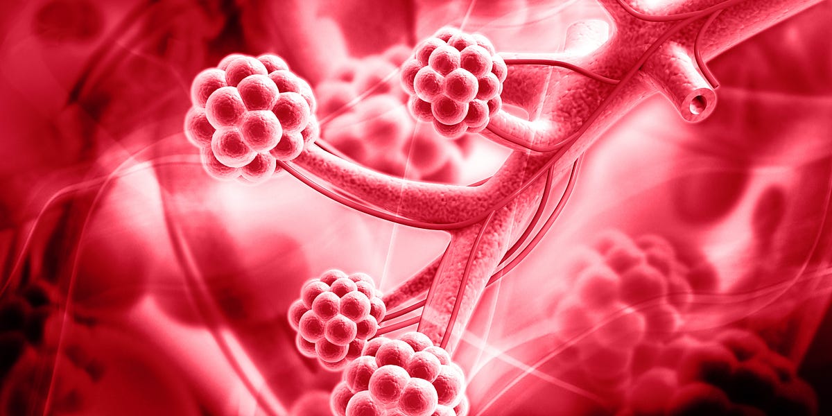 2023 ATS vs ESICM Guidelines for ARDS: How They Differ