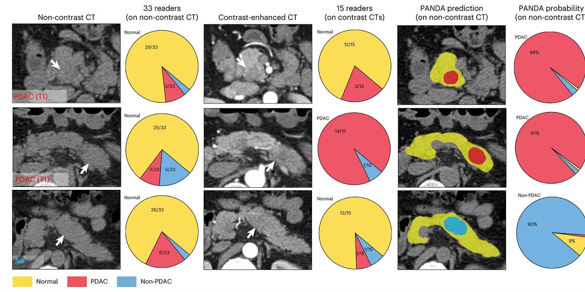 Pancreatic Cancer Detection, Carbon based Energy Storage and Rogue Waves