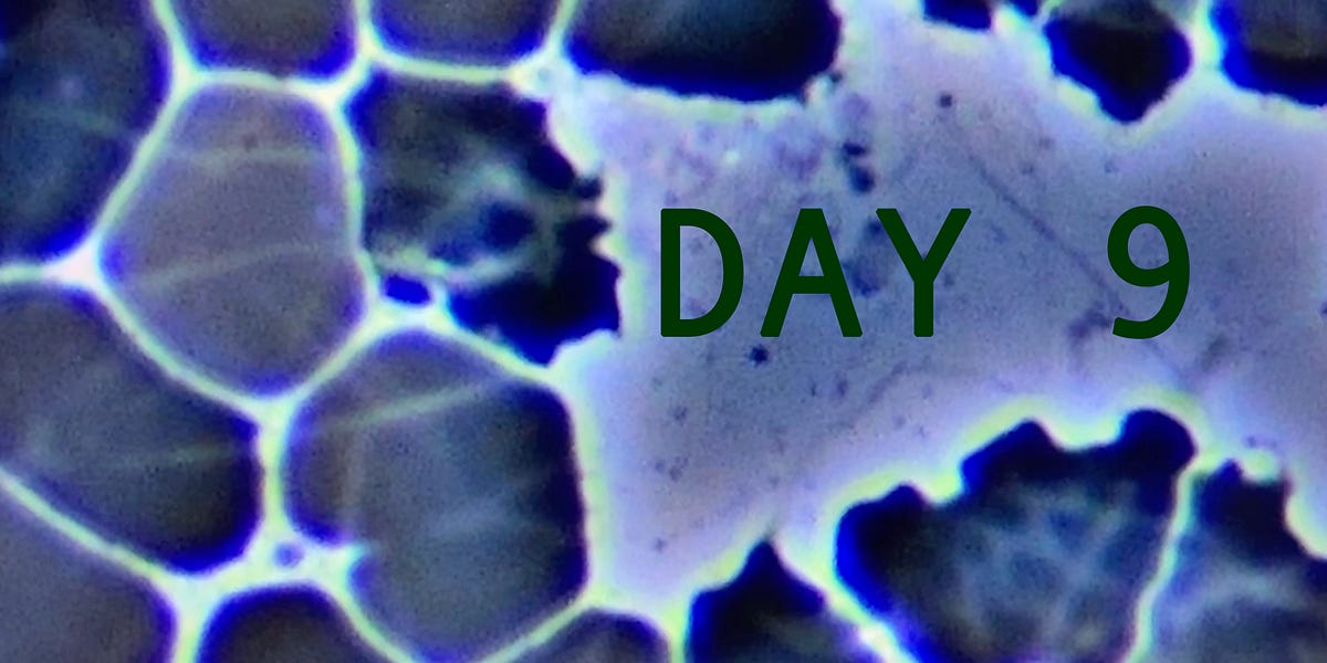 Day 9 in the Life of Dead Blood of a Targeted Individual