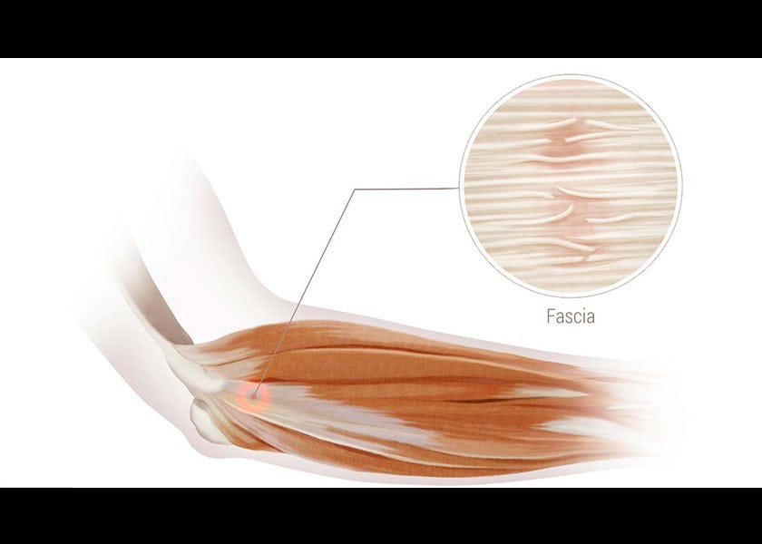 Unveiling Fascia: The Role of Connective Tissue in Pain and Mental ...