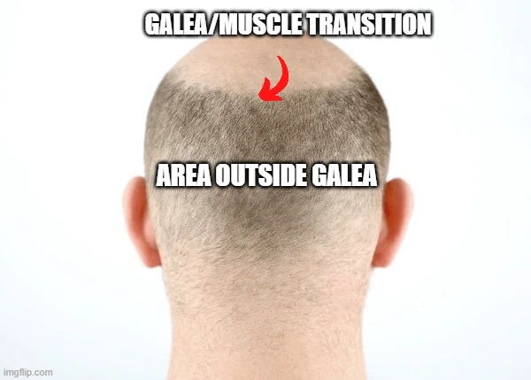 Galea/Skin-Tension; Explanatory Images...