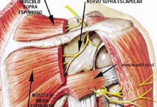 Neuropatia do supra-escapular - Causas, sitios de compressão e casos ...