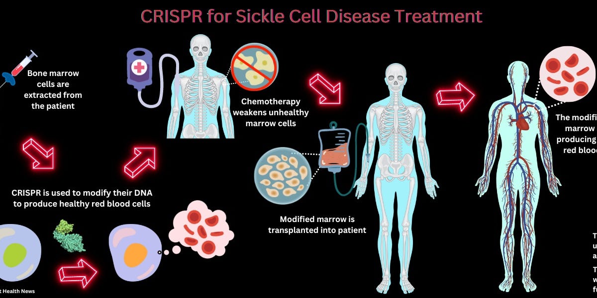 Gene Editing Explained: CRISPR Treatment for Sickle Cell Disease