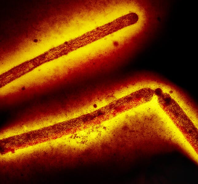 Finland to offer bird flu vaccine to select groups of people, a ...