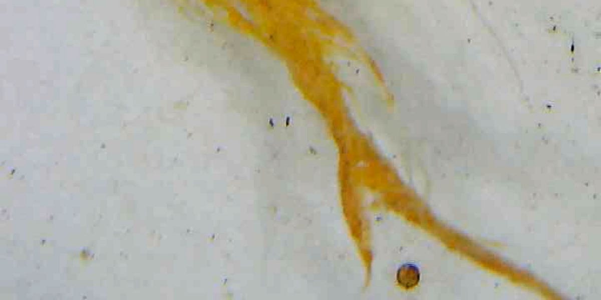 Introduction of the Specimens I've Evicted - Kim’s Substack