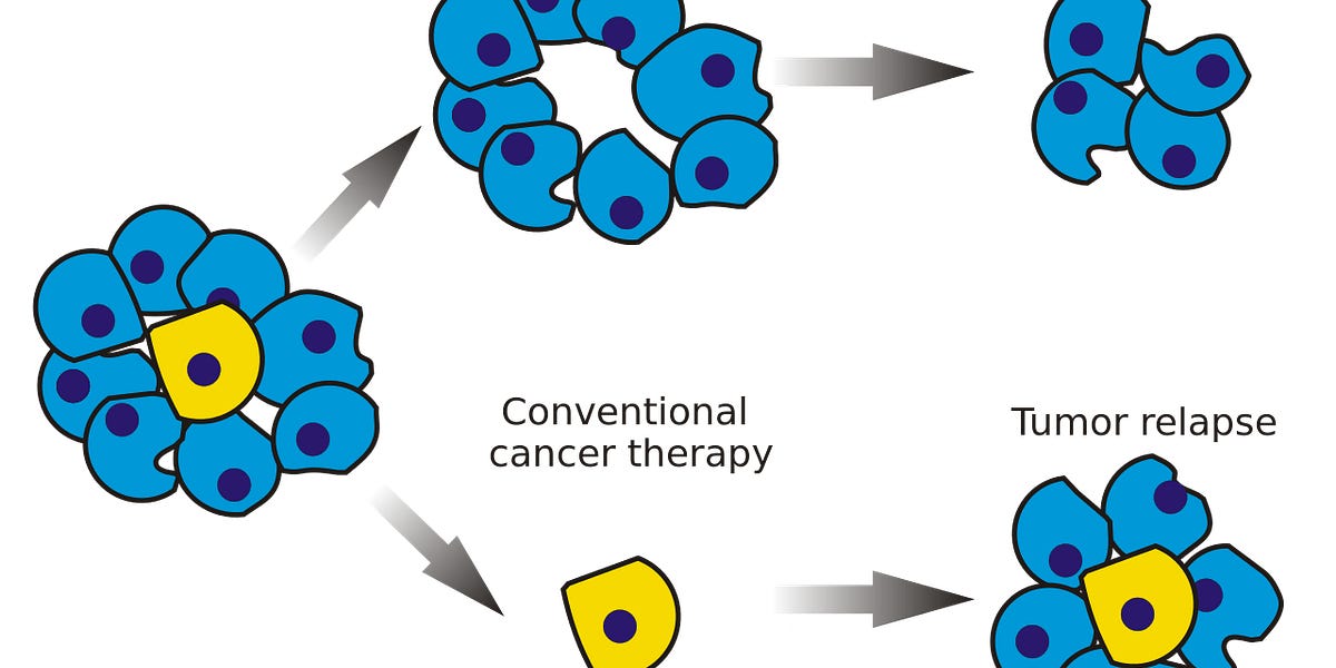 PREŽITIE RAKOVINY PANKREASU – ROZPRÁVANIE LEKÁRA