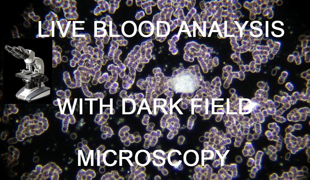 Live Blood Dark Field Microscopy Analysis: Conversation with an Expert ...