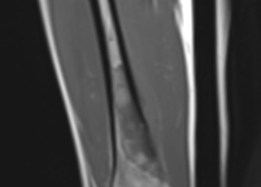 Ethan and Pain to Nausea - by Aimee Jobe