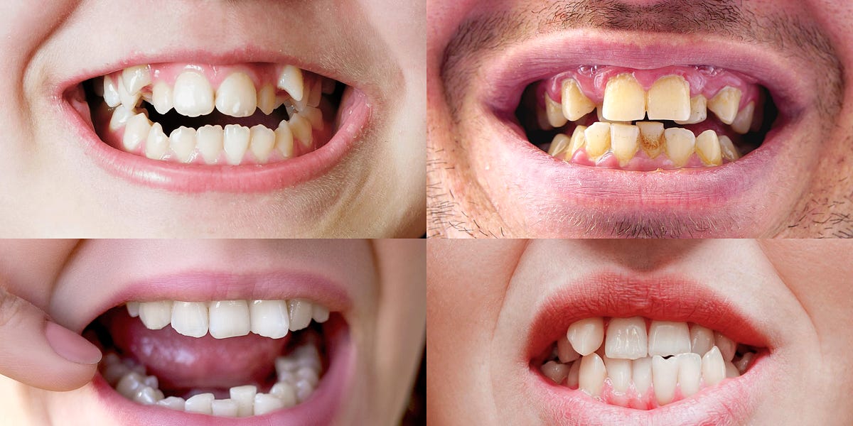 1.1 The Silent Epidemic - by Ronald Ead - JawHacks