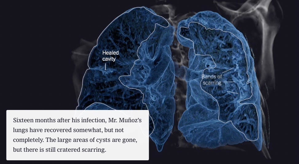 Making something better doesn't determine that it was intolerably or ...