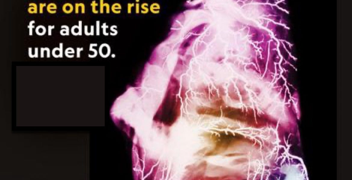 How To Get A Cardiac CT Calcium Score - I Discovered My Heart Is ...
