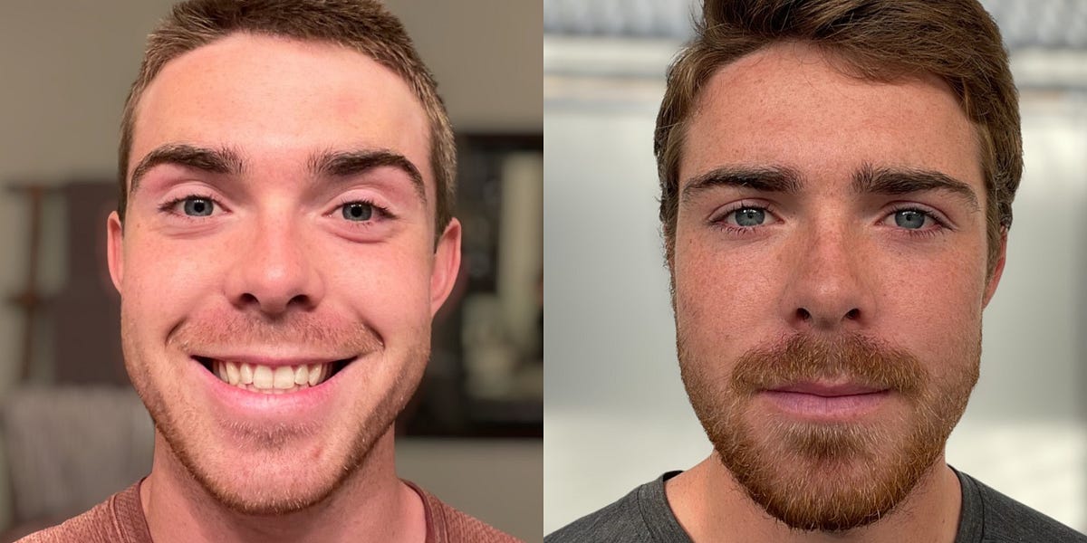 Feeling Fire and Ice - by Garrett Kincaid - The Intronaut