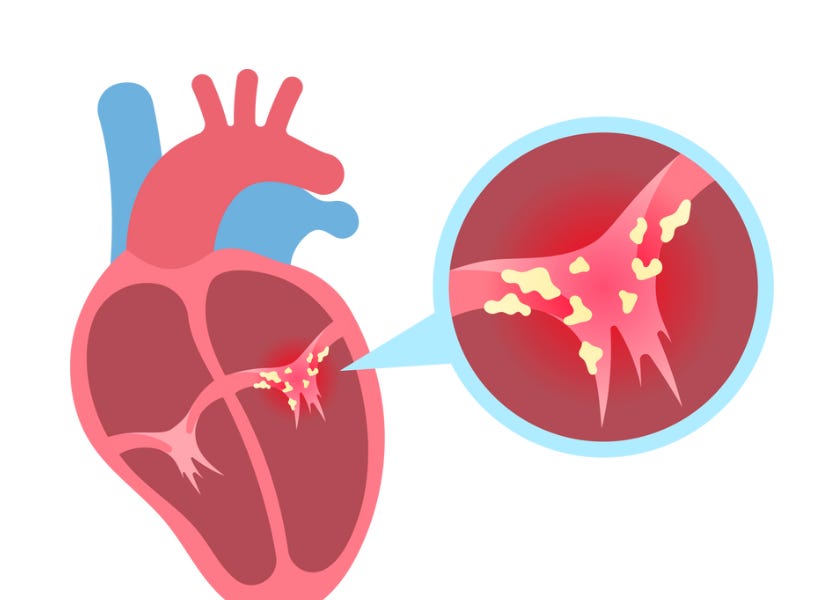 Endocarditis infecciosa canina - by Carlos Martínez Gil