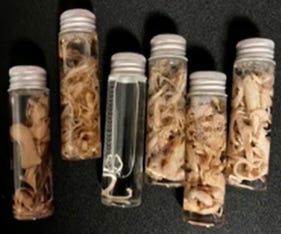 CONFIRMED: "Calamari Clots" Being Pulled From the Living, Embalmers ...