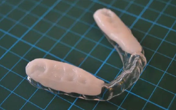 Indexed splints and the magical "perfect jaw position"