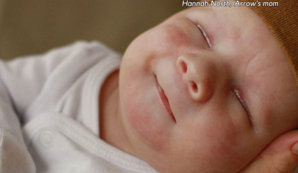 Arrow was prenatally diagnosed with Trisomy 13. Doctors didn’t tell her ...