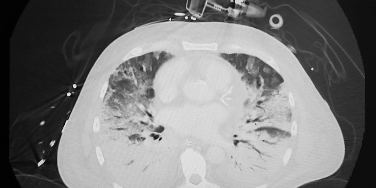 The Latest in Critical Care, 6/26/23 (Issue #6)