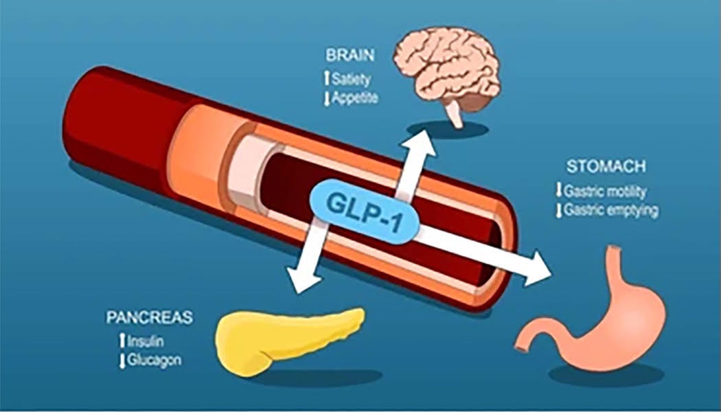 GLP Injections Explained: The Modern Marvels of Diabetes and Weight ...