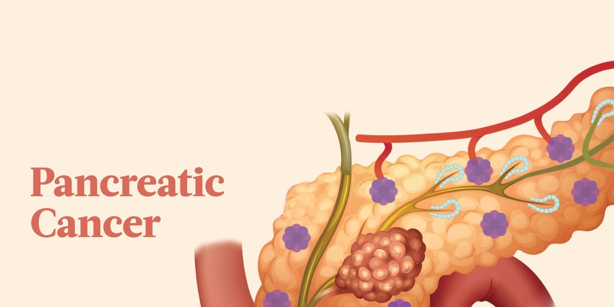 The Essential Guide to Pancreatic Cancer: Symptoms, Causes, Treatments ...