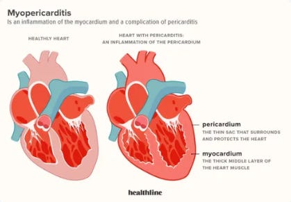 Medical Mystery: A Case Of Recurrent Myo-Pericarditis In A 20-Year-Old ...