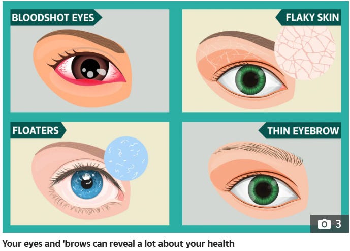 EYE SEE From thinning brows to floaters and flickering – the health ...