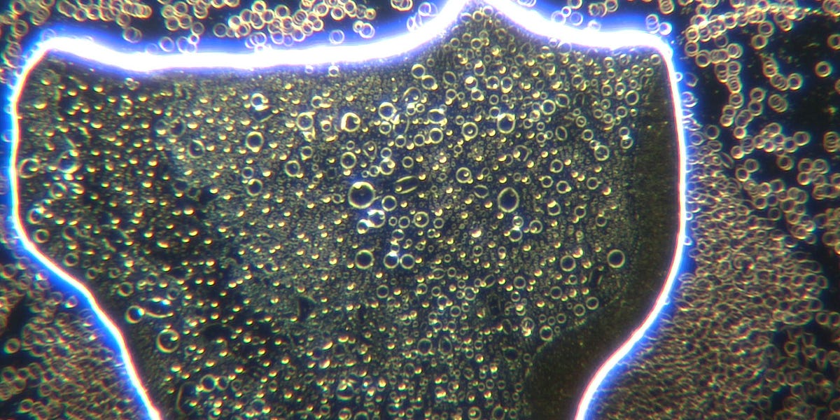 Astonishing Darkfield Live Blood Footage Of Nano/Microrobots In C19 ...