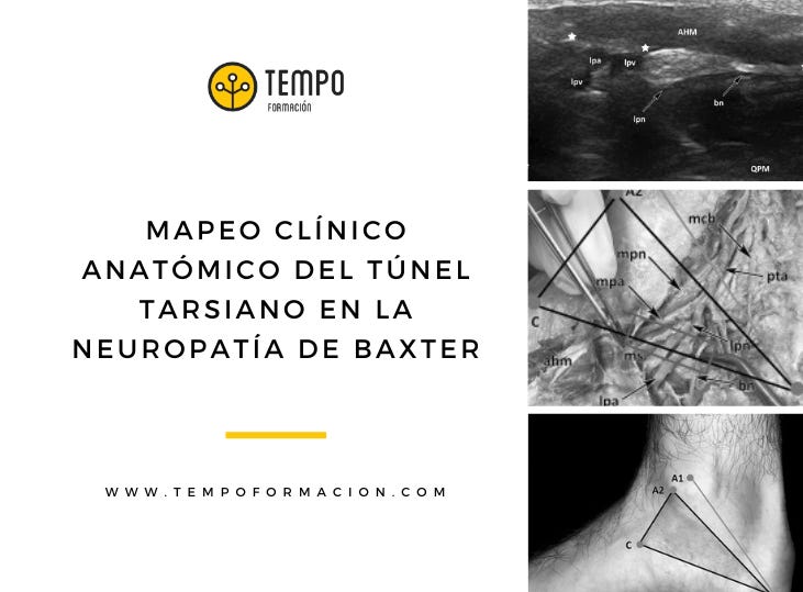 Túnel tarso y Neuropatía de Baxter - by Tempo Formación