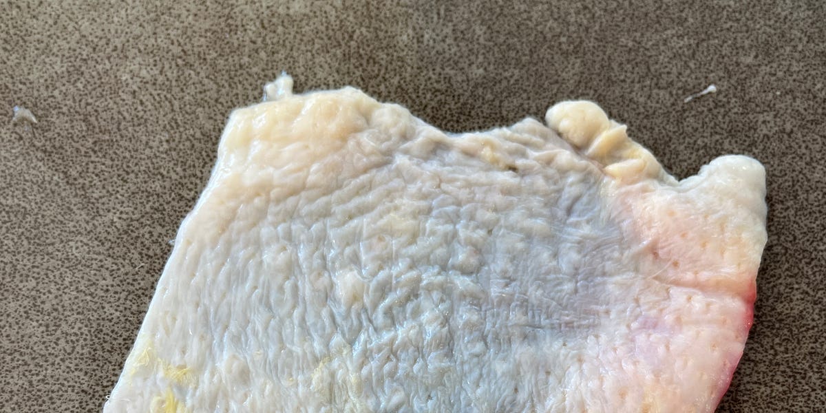 Fried Trachea - Anatomy Eats’ Substack