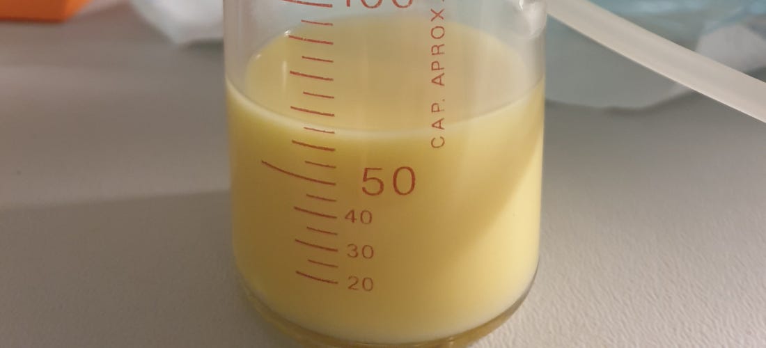 When to consider colostrum harvesting - by Beyond Birth