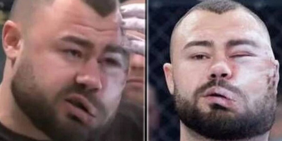 Slap Fighting: The Ridiculous and Dangerous Sport That Needs to be Stopped