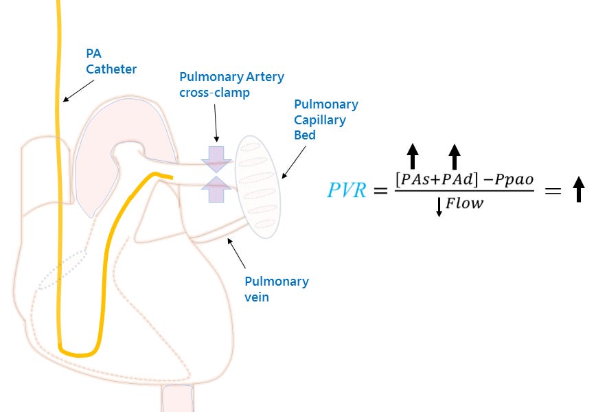 ICU Physiology in 1000 Words: The Folly of Pulmonary Vascular Resistance