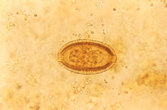 A Potentially Fatal Parasite First Seen in the Philippines