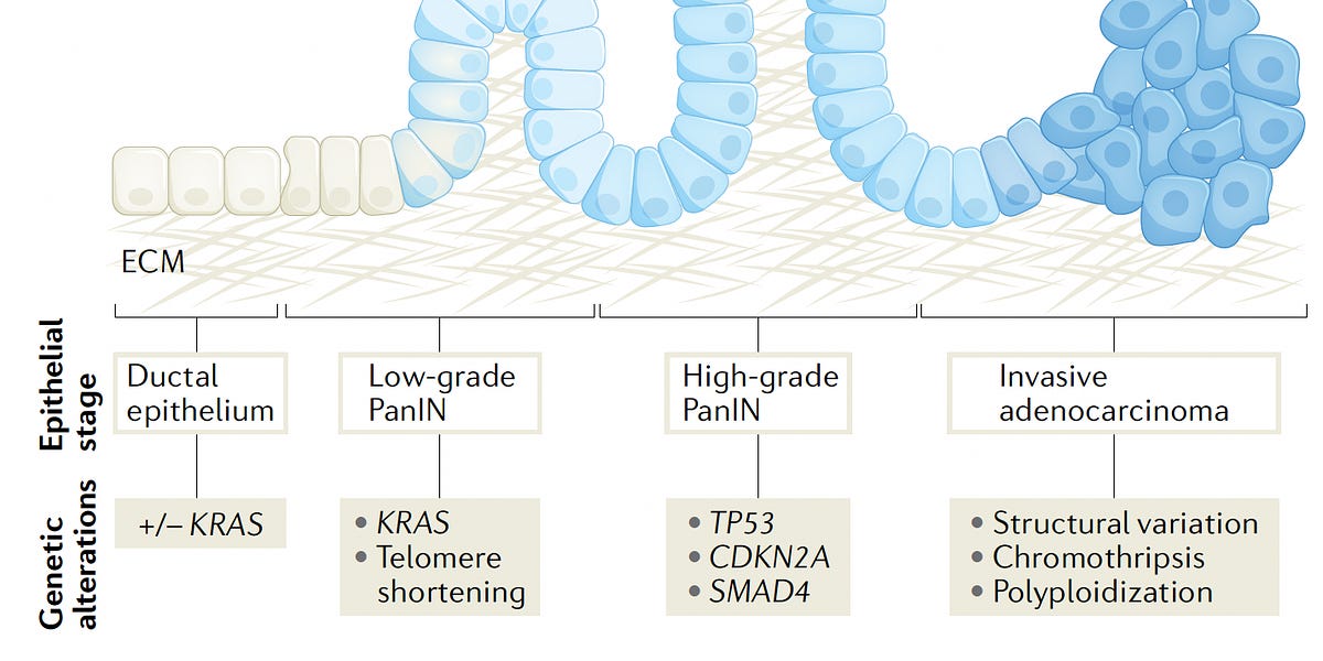 A one-two punch against pancreatic cancer - by Eric Topol