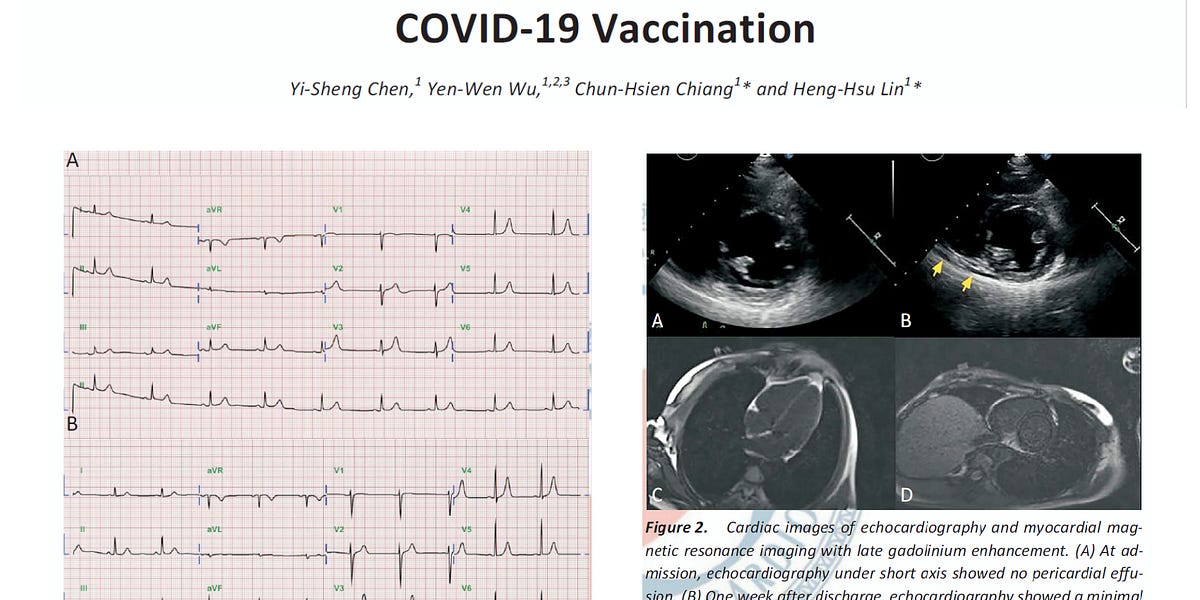 Antinuclear Antibody Positive Pericarditis after mRNA Vaccination
