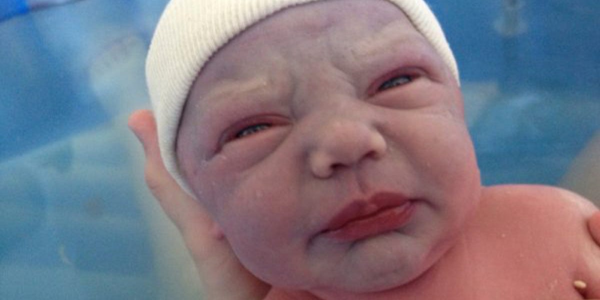 Pediatric Pearls. Infant's Skin: More Color Variations