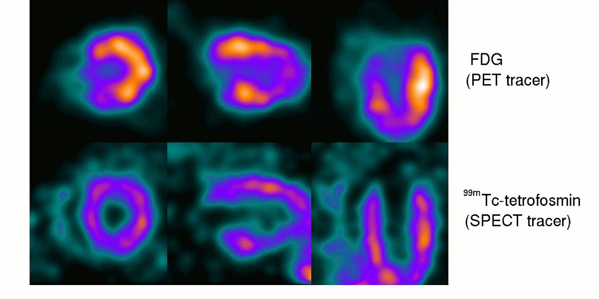 Nuclear medicine: 18F-FDG PET/CT for the detection of vaccine-induced ...