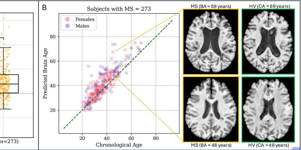 ACTRIMS 2025: How old is your brain? - by Gavin Giovannoni