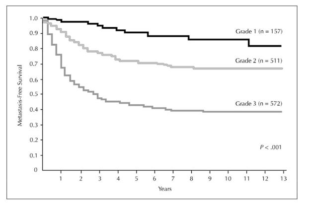 Grading in Soft Tissue Sarcomas - by Brian Schulte