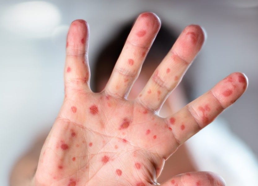 offGuardian rude and derisive admin comments