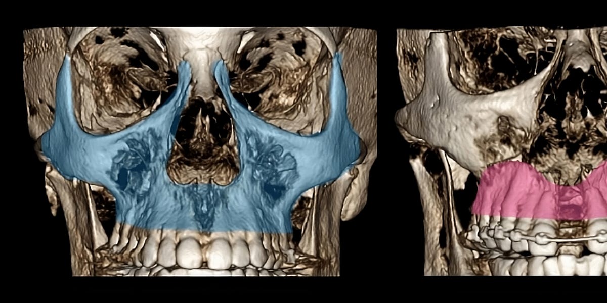 1.4 Expanding for Aesthetics Only - by Ronald Ead