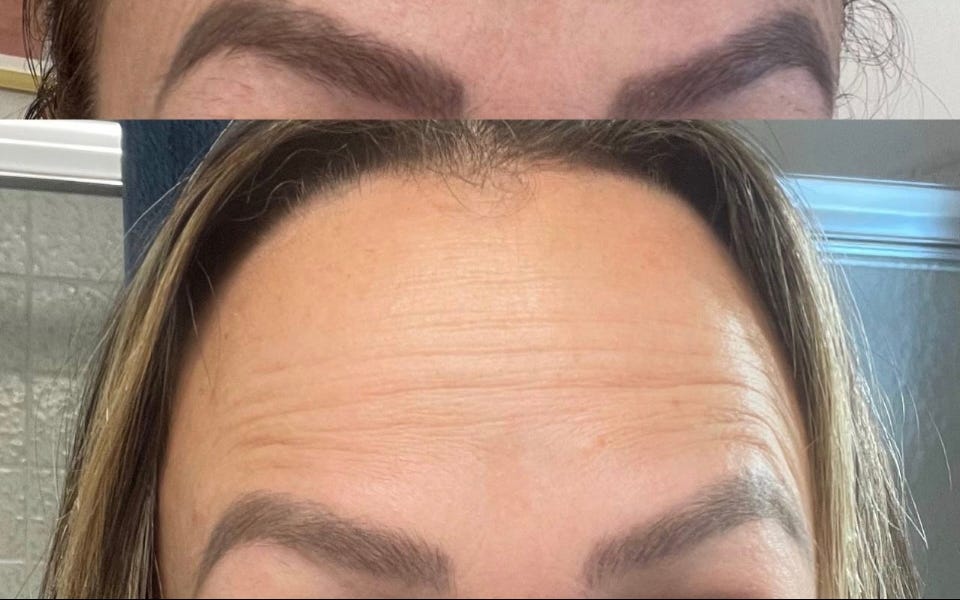 Natural Botox in a Bottle - by Heather Queiroz - GenX Girl