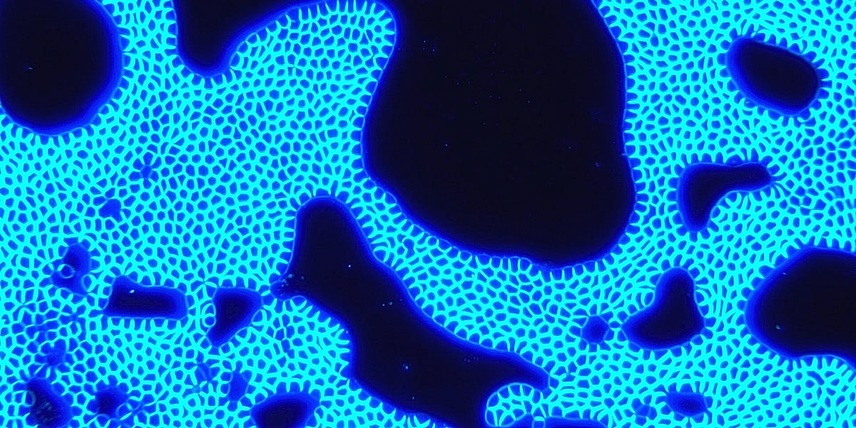 A long boring post. - by matt. j.a.o.b - matt’s microscopy