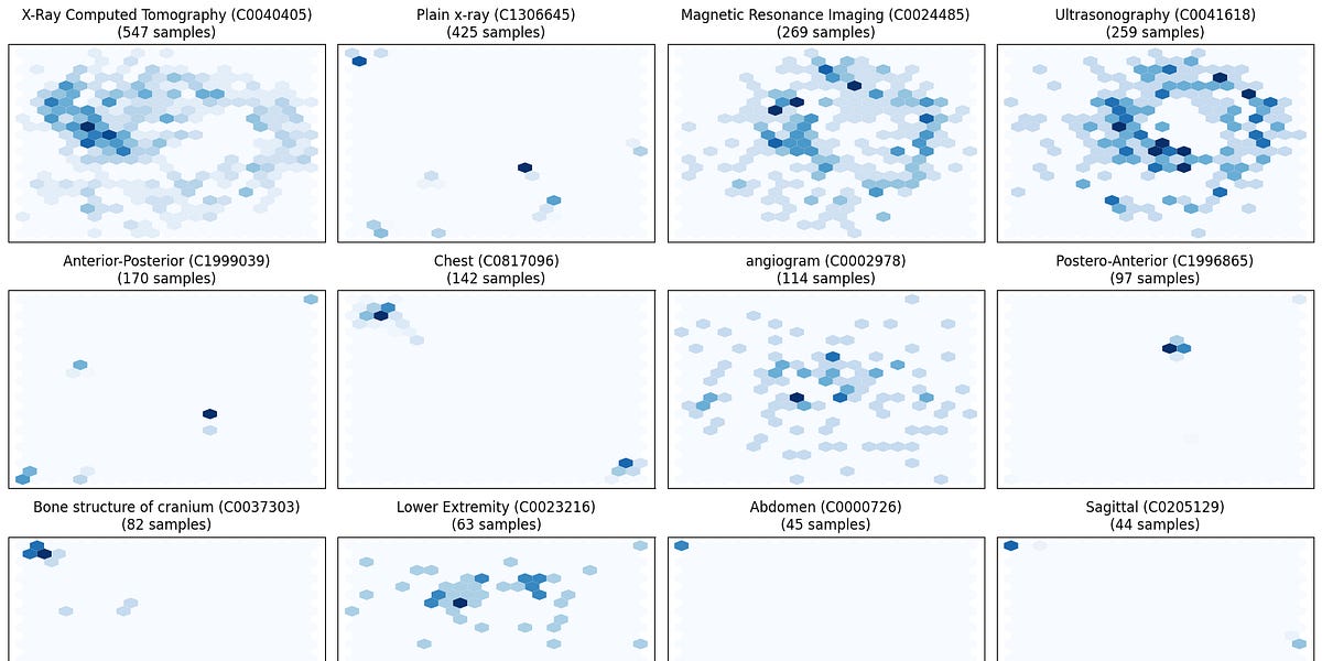 ModernBERT in Radiology Part 1: Simple Classifier using Hidden States