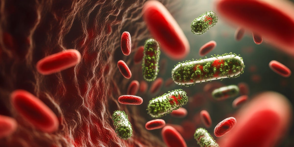 A Response to the NEJM's Sepsis Review Article - PulmCCM
